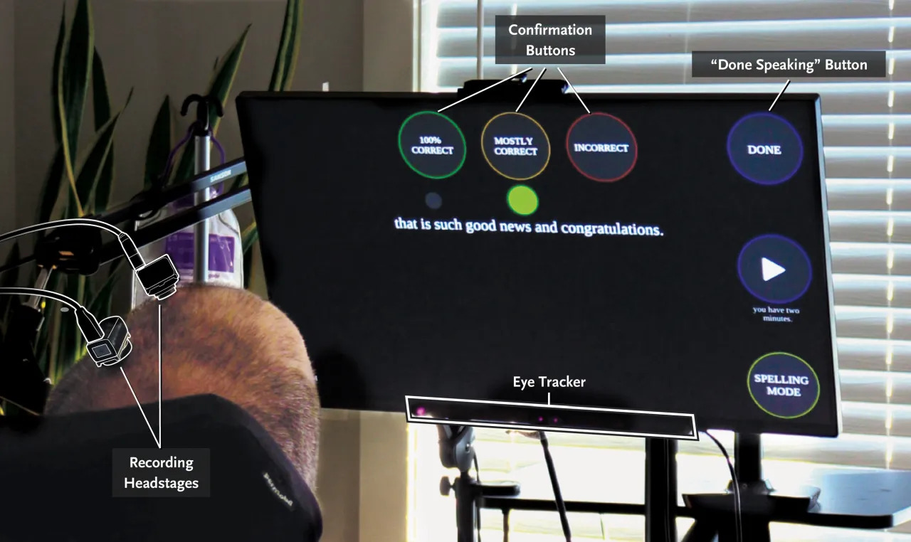 Implant mózgowy BrainGate2 pozwala sparaliżowanym mówić i śpiewać ...