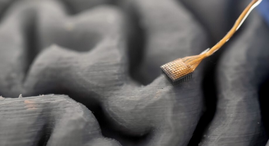 Implant mózgowy BrainGate2 pozwala sparaliżowanym mówić i śpiewać ...